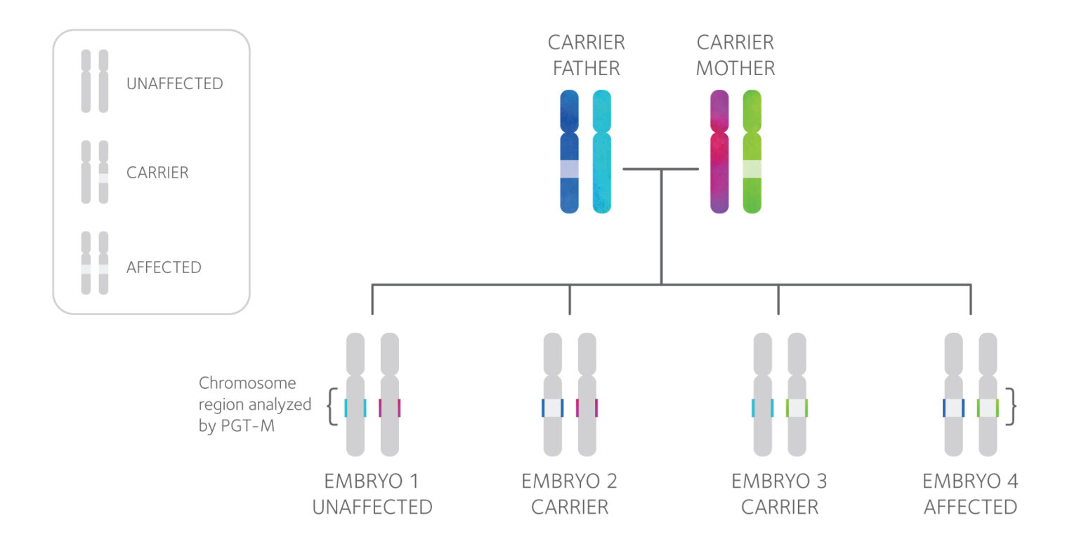 PGT-M - Preimplantation Genetic Testing