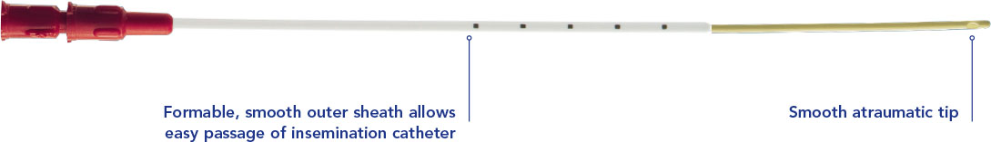 Wallace® Intra-uterine Insemination Catheters - CooperSurgical